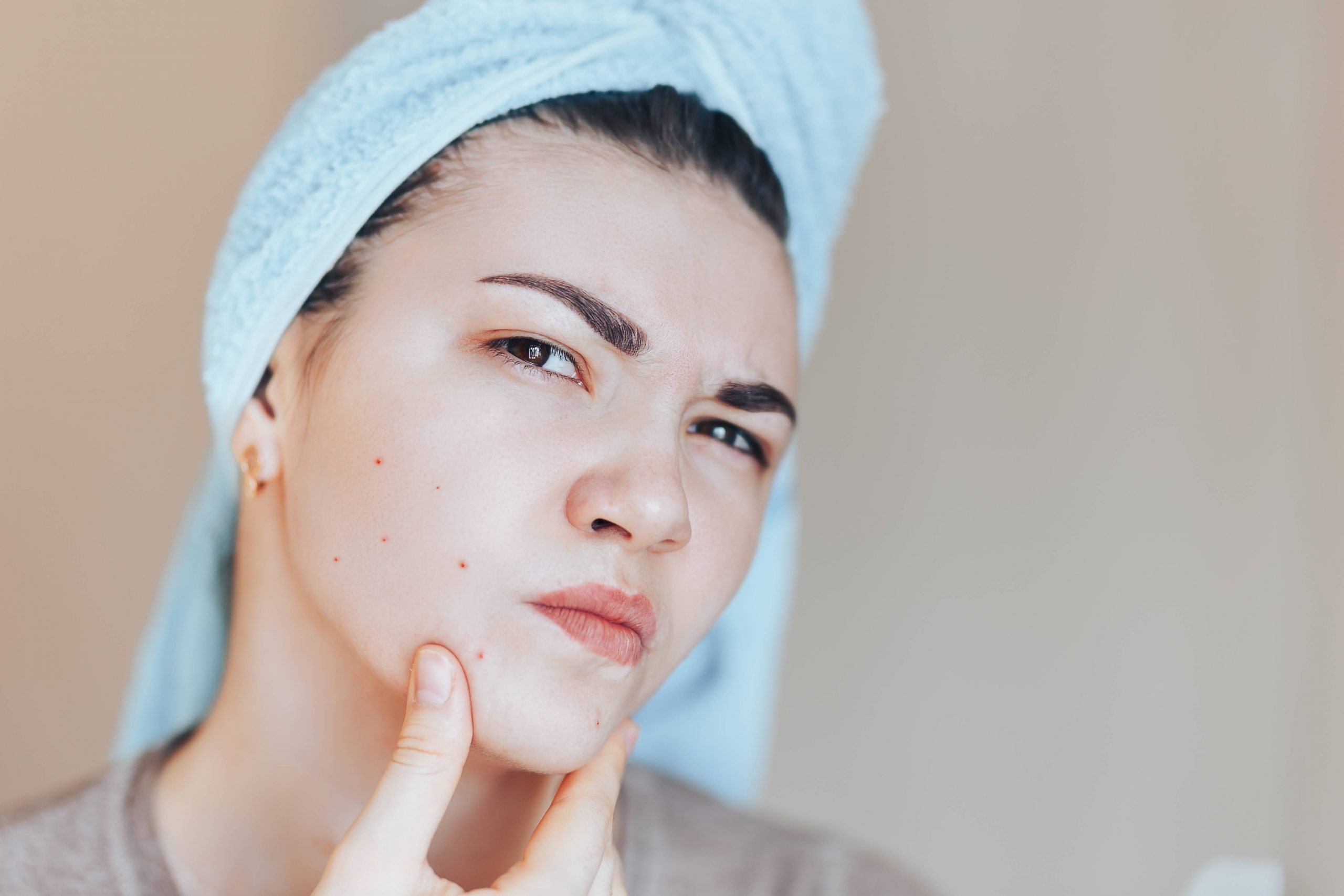 Top 7 Affordable Acne Products Under $20 · Care to Beauty