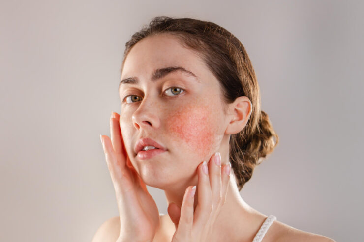 Why Does My Face Burn After Applying Skincare· Care to Beauty
